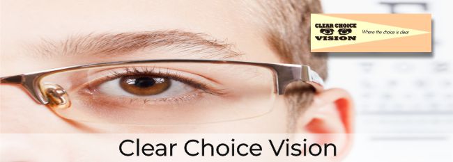 Clear Choice Vision Center Services